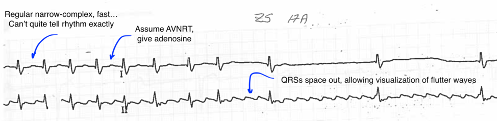 Adenosine – The Clinical Problem Solvers