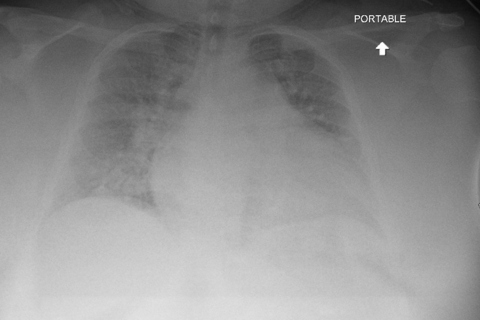CXR – The Clinical Problem Solvers
